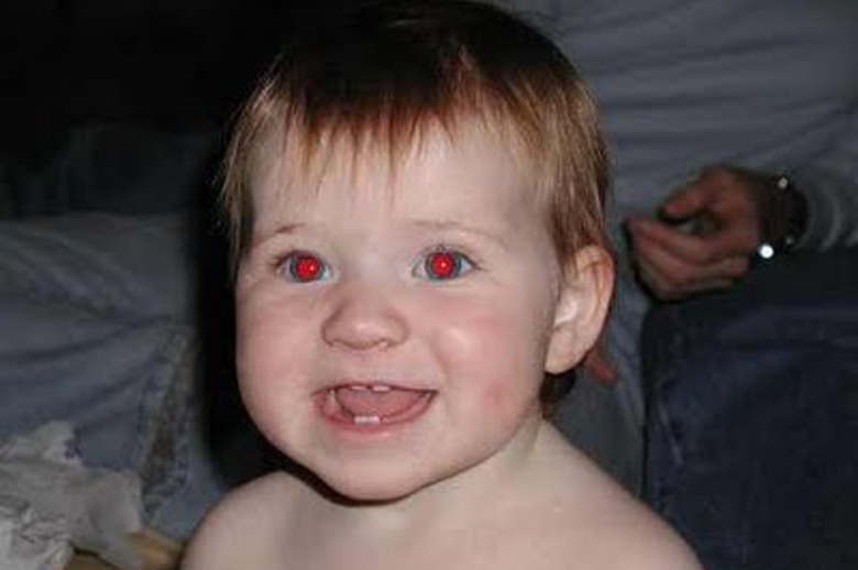 Mengapa Saat Foto Terdapat Efek Merah Pada Mata?