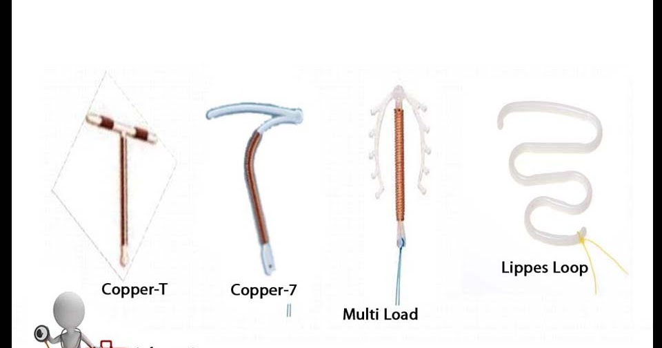 KB- AKDR (Alat Kontrasepsi Dalam Rahim)