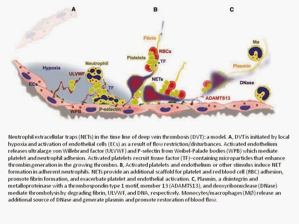 vascular ( blood vessels): NETs and Deep vein thrombosis
