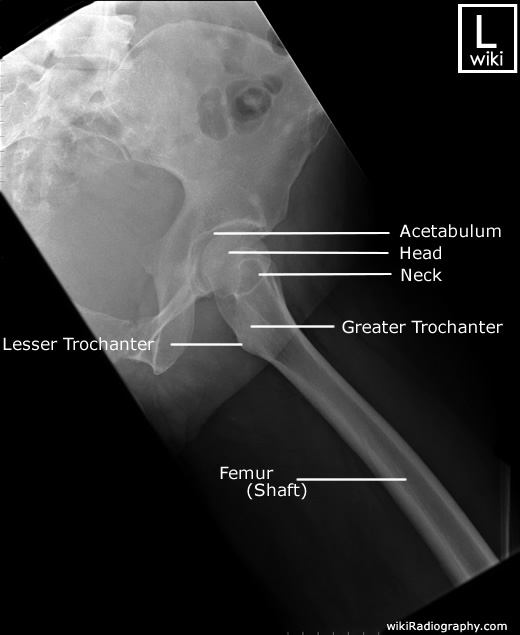 ANATOMI RADIOGRAFI FEMUR - Radiografer