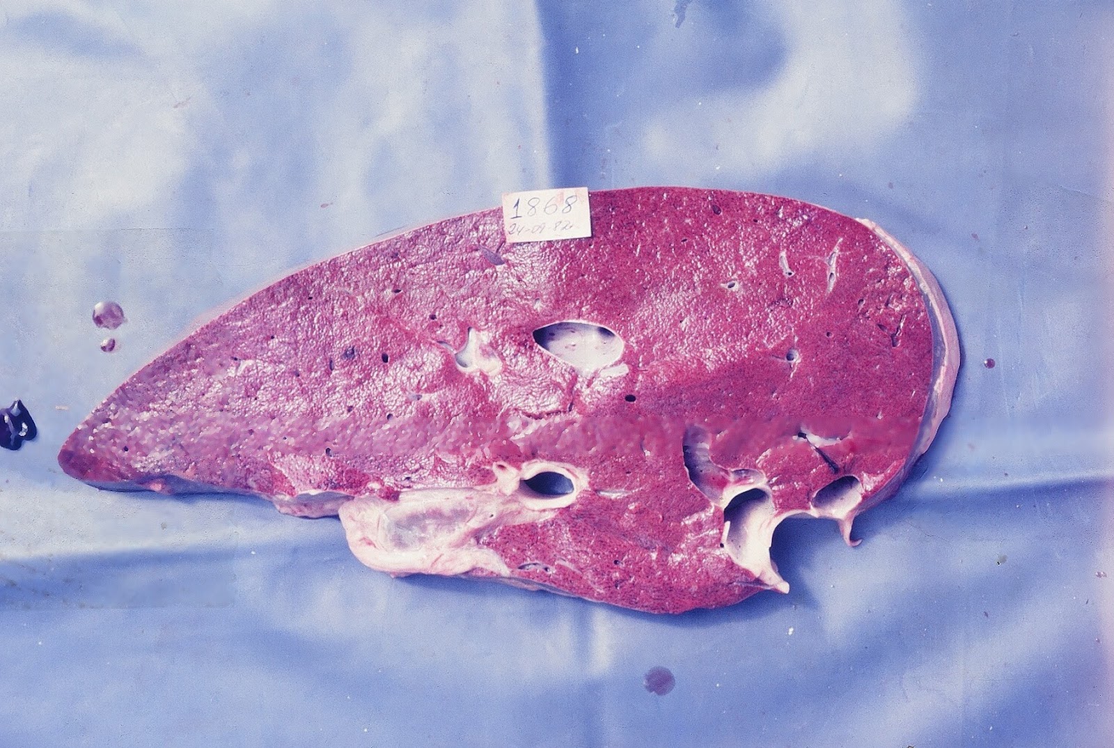 Patologia Veterinária: Necrose hepática