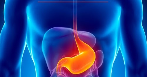 TANDA-TANDA GASTRIK, PUNCA DAN RAWATANNYA