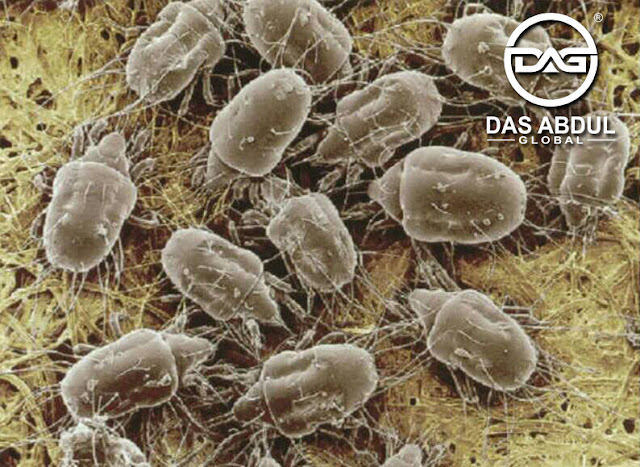 Hama Debu Rumah - Punca Masalah Alahan - Bantal Hotel DAG Perak