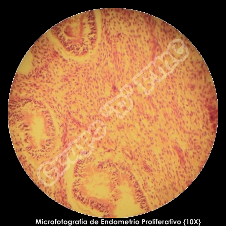 Histologeando: ENDOMETRIO