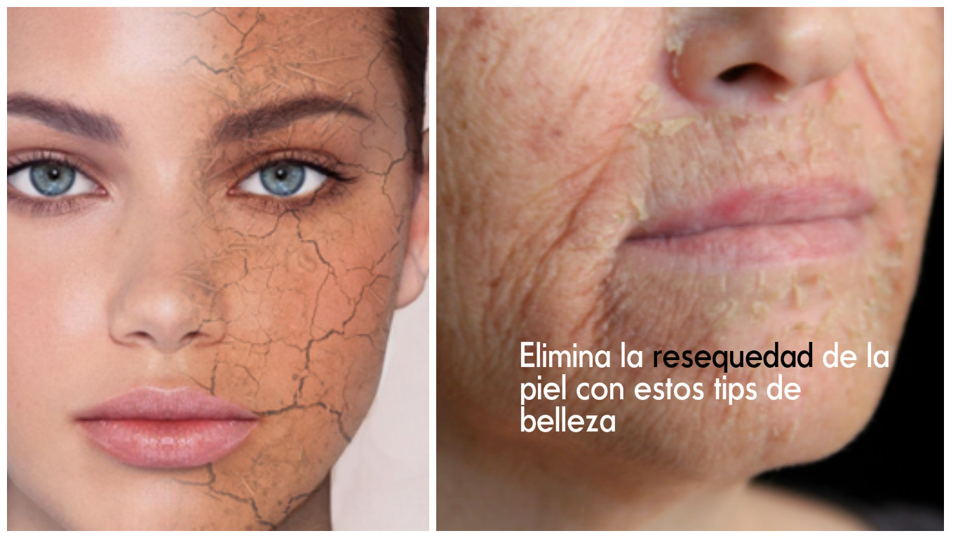 ¿ Tengo la piel seca ? Qué hago - Aquí la respuesta ~ Belleza y Peinados