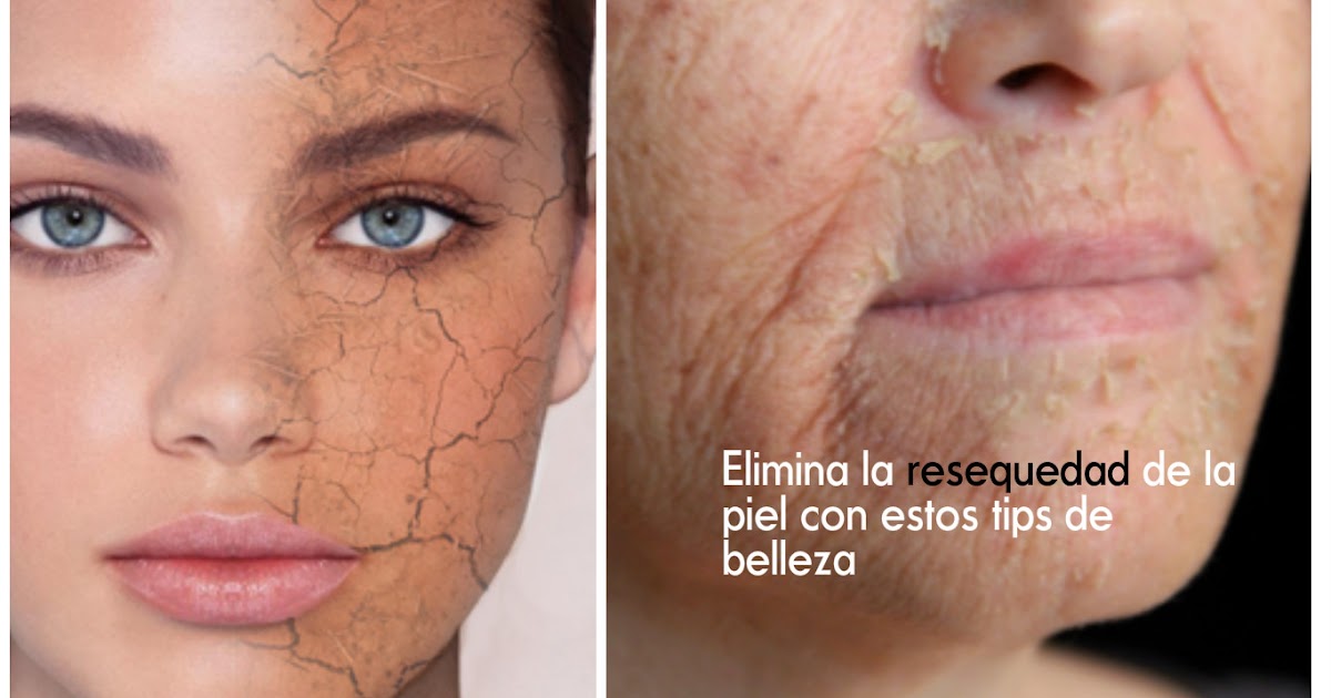 ¿ Tengo la piel seca ? Qué hago - Aquí la respuesta ~ Belleza y Peinados