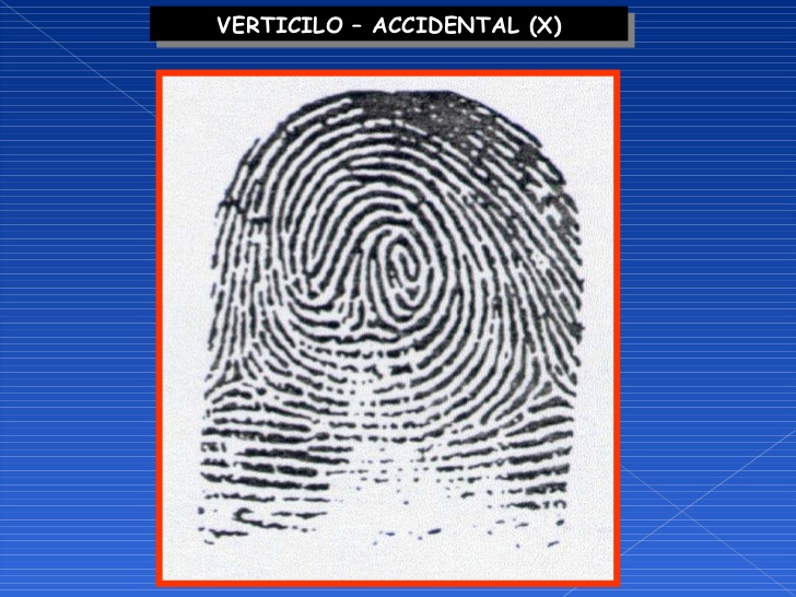 Diferentes Tipos de Dactilogramas