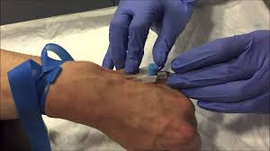 Técnicas Enfermeras: Canalización de vía periférica