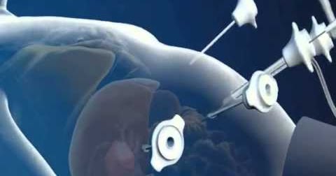 Exploration of the Medical Field: Advancements in Surgery Operations