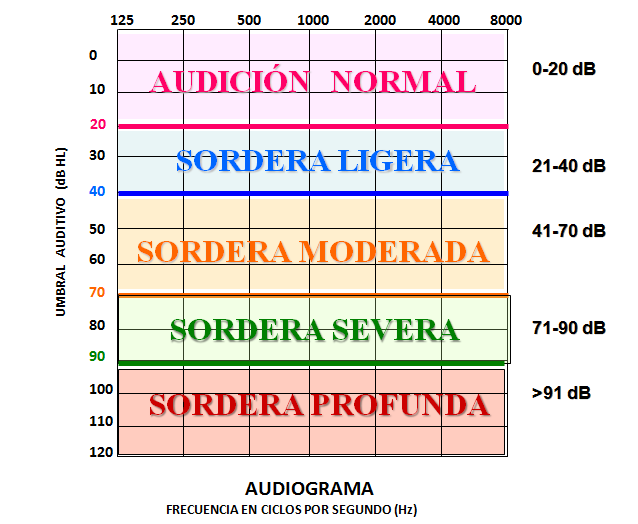 Audiòfon Balear Menorca: Tipos, grados y configuración de las ...