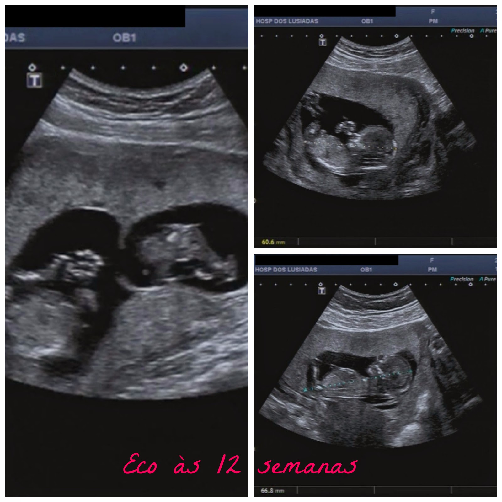 O Diário da Minha Gravidez: 12 semanas + 5 dias de gestação: Vem aí um ...
