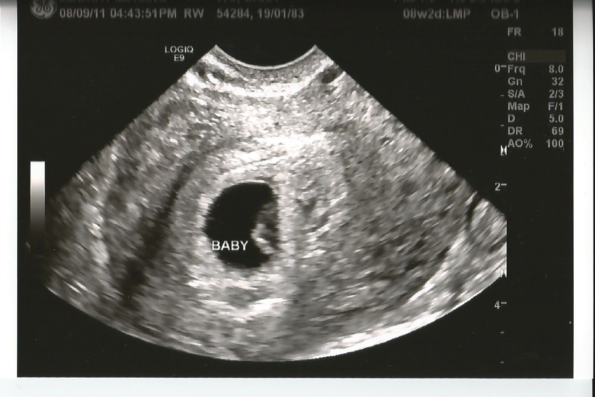 My Journey Into Motherhood...: First Doctor's Visit, First Ultrasound ...