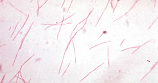 Variety of Life: Fusobacteria