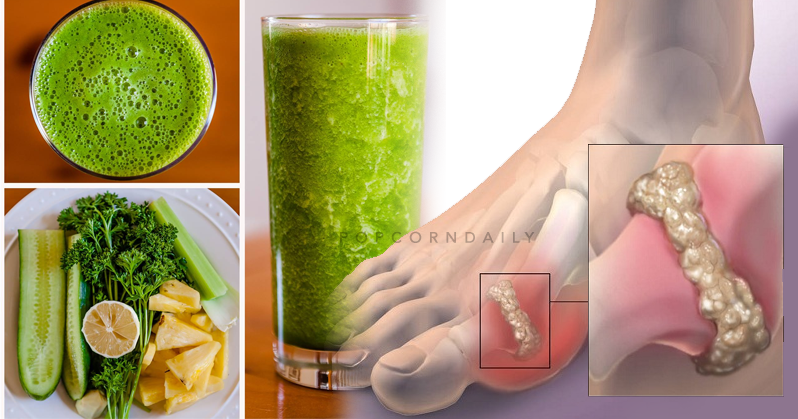 Remove Uric Acid From Your Joints With This Natural Recipe