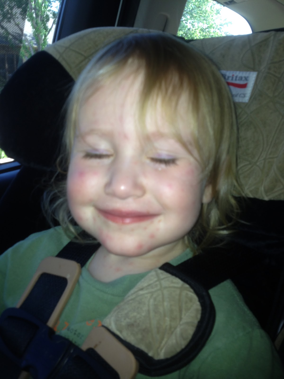 Baby Baker Blog: Toddler Fevers and Rash