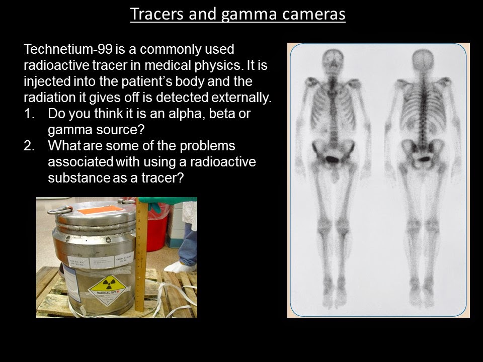Mr Lloyd's Interactive Board: Y13 Radioactive tracers and the Gamma Camera
