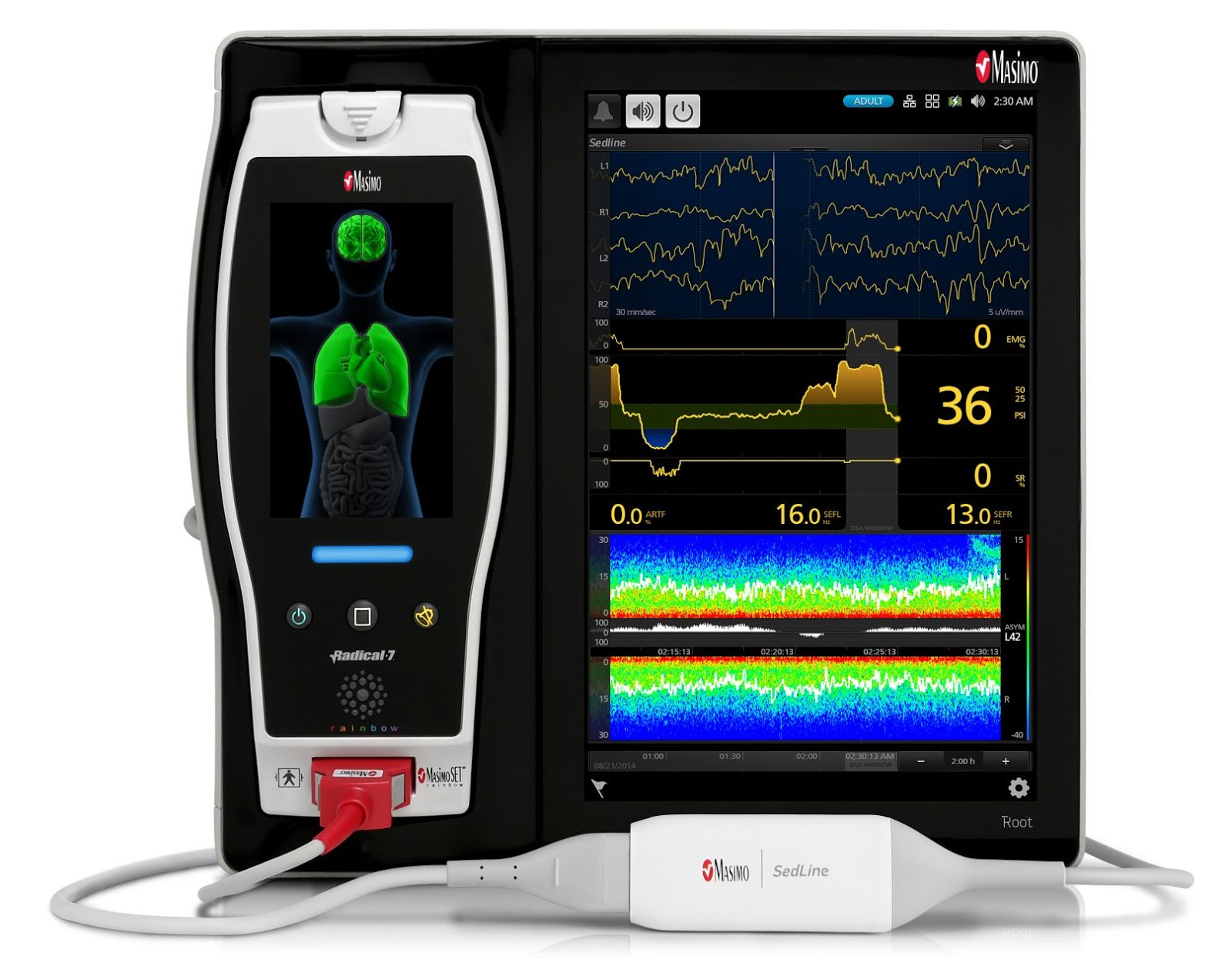 ME Newswire: Masimo to Showcase Next Generation SedLine® Brain Function ...