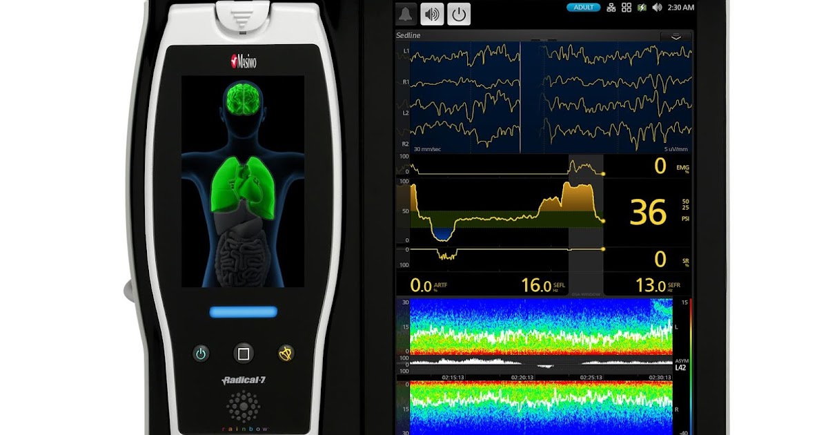 ME Newswire: Masimo to Showcase Next Generation SedLine® Brain Function ...
