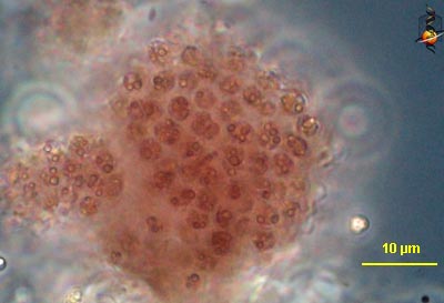 Variety of Life: Chromatiaceae