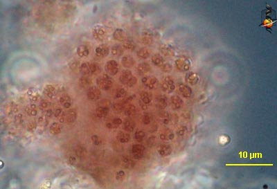 Variety of Life: Chromatiaceae