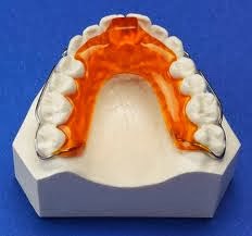 What is a Deprogrammer? | Ask Dr. Spindel