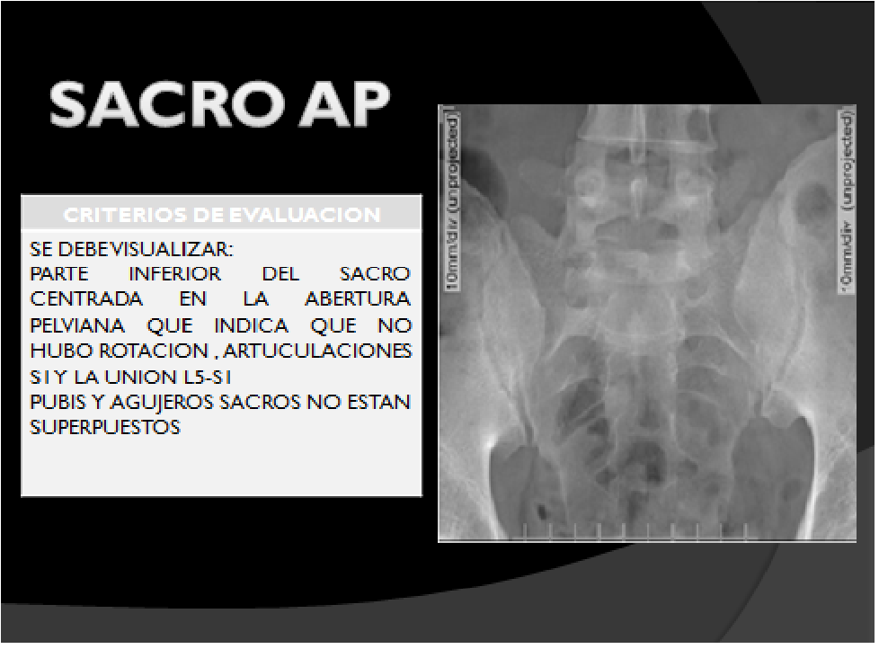 Criterios De calidad Y Evaluación De Las Imágenes radiograficas ...
