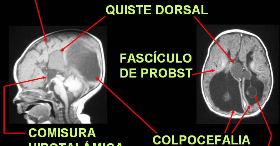 ¿SABÍAS EN QUÉ CONSISTE?