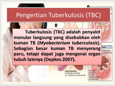 Merk obat batuk tbc anak denature