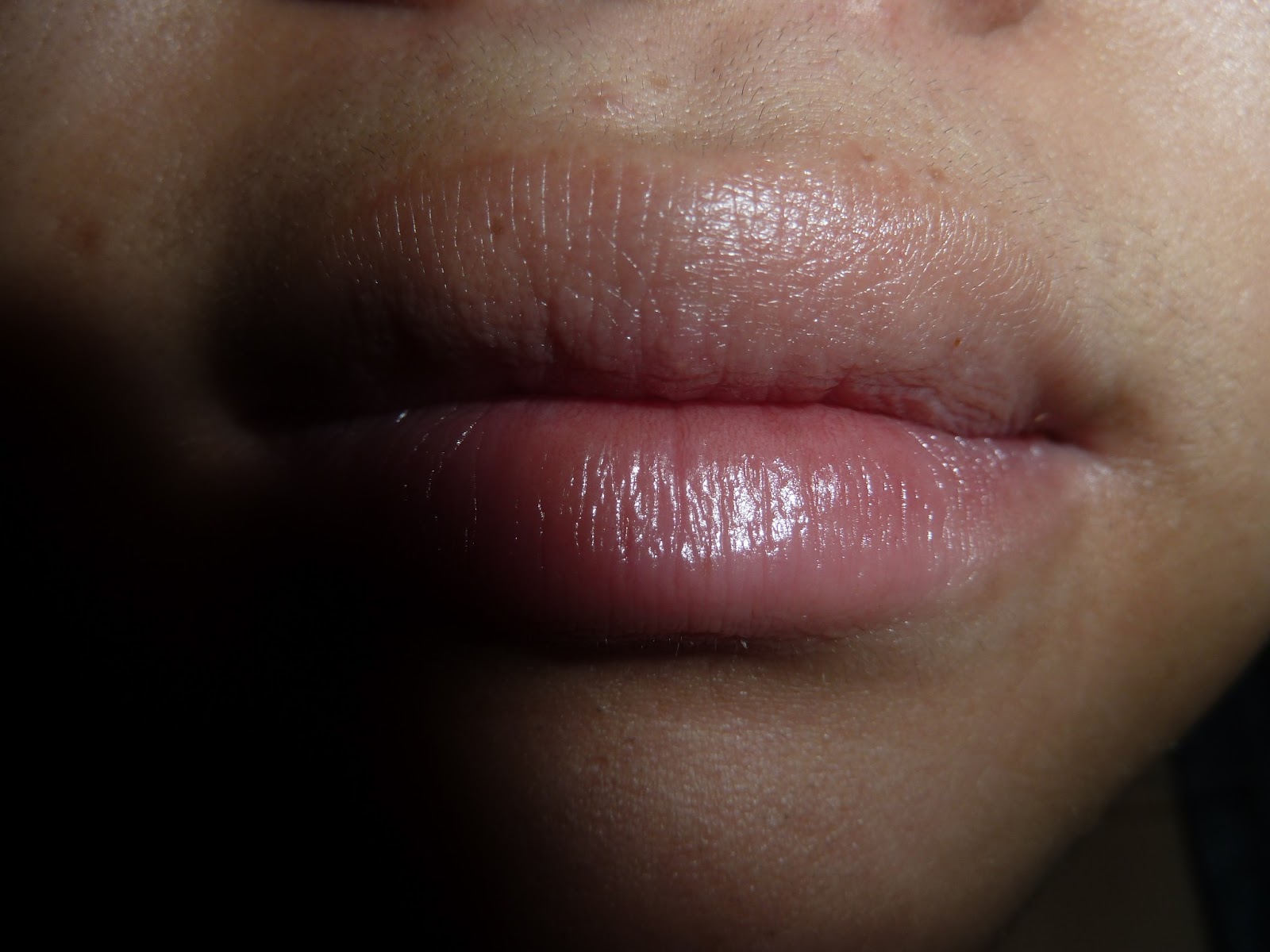 Solution to Chapped Lips | Zowie Power