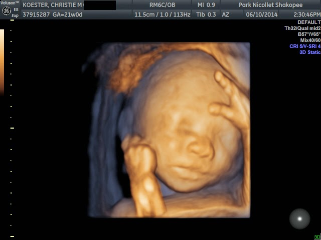 20 Week Level II Ultrasound - Baby #2 ~ Christie Koester