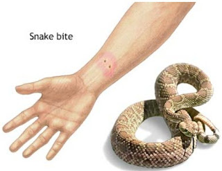 Blog Keperawatan: Perawatan vulnus/Luka