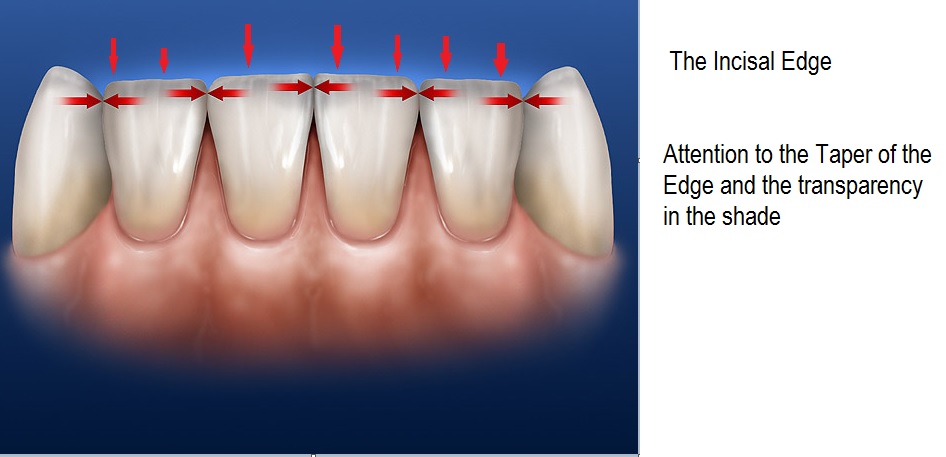 Step by Step Guide to Choosing the Top 3 Criteria to a Natural Dental ...