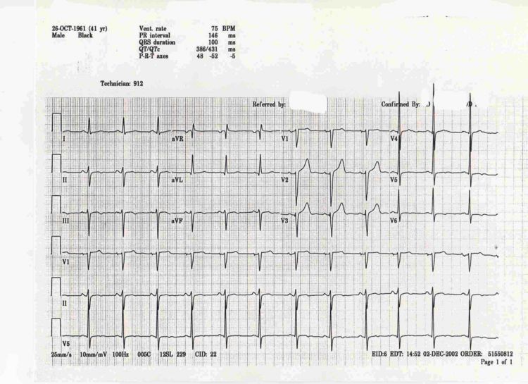 Phimaimedicine: 1,287. Left anterior hemiblock