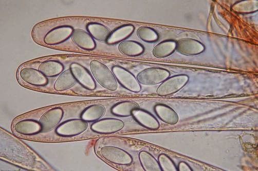 Microbiología: Tipos de Hongos