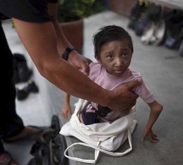 OMG World: OMG! Smallest Man In The World From Nepal