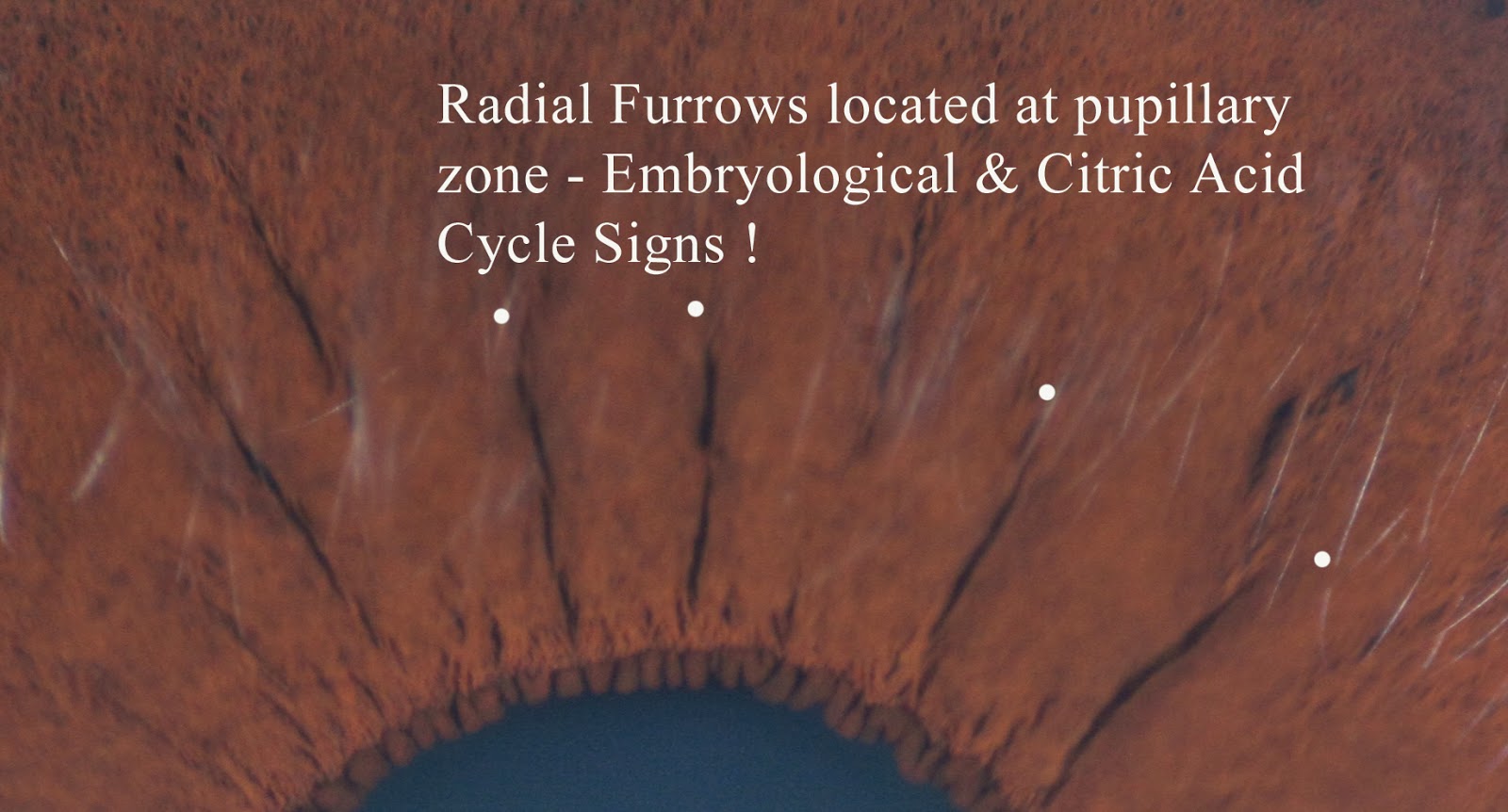 Modern & Multidimensional Iridology: Iris Signs on Neurogenic Structure ...