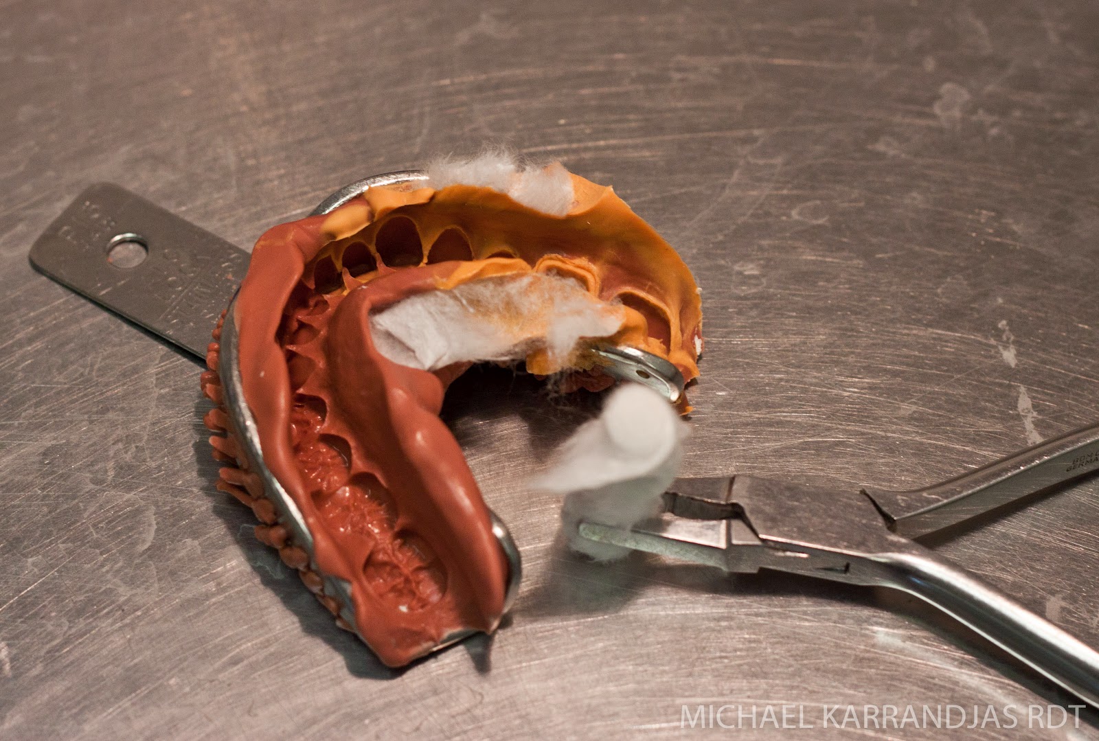 Dental Lab Model Pouring | Making Noise And Drinking Beer