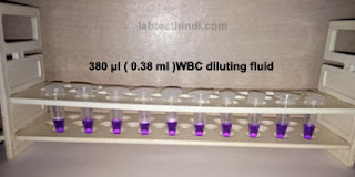 Total Leukocytes Count (TLC) Test कैसे करते है - Bulk Dilution ~ Lab ...