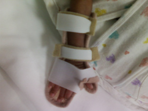 Pépi Splint By MWDesign Core77 Design Awards, 54% OFF