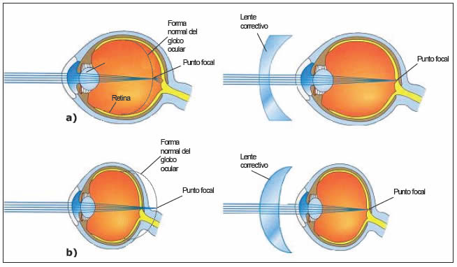 FISIOLOGÍA DE LA VISIÓN I: MECANISMO DE ACOMODACIÓN