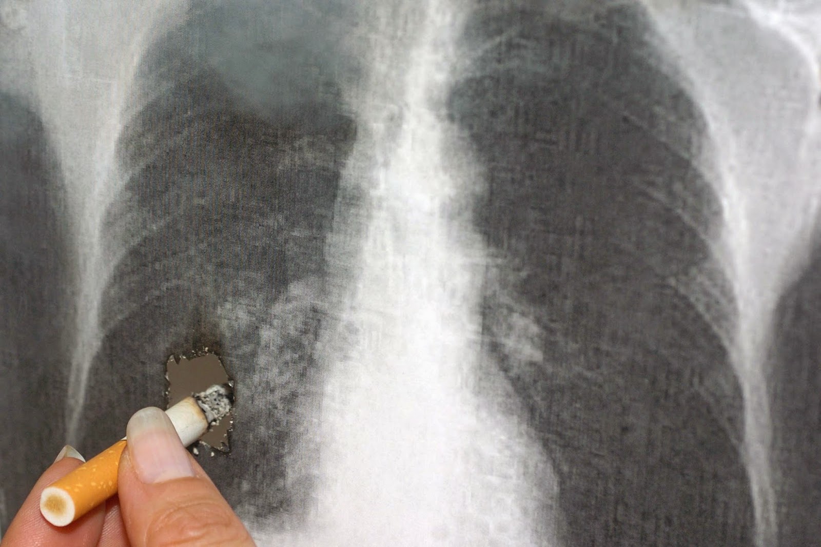 En hverdag med KOL: Har du KOL?