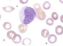 FICHERO HEMATOLOGIA : Metamielocito neutrófilo