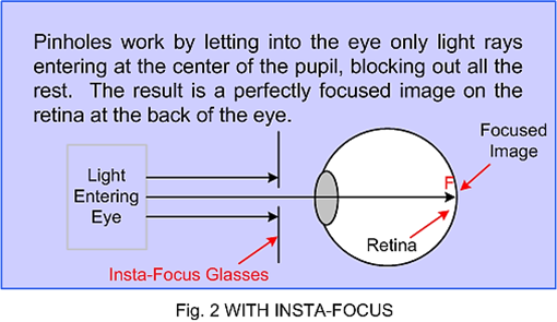 Cermin Mata Terapi (Pinhole Glasses): Cermin Mata Terapi Terapi ...
