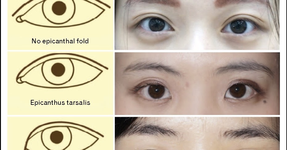 Epicanthal Folds Finnish Eyes ~ news word