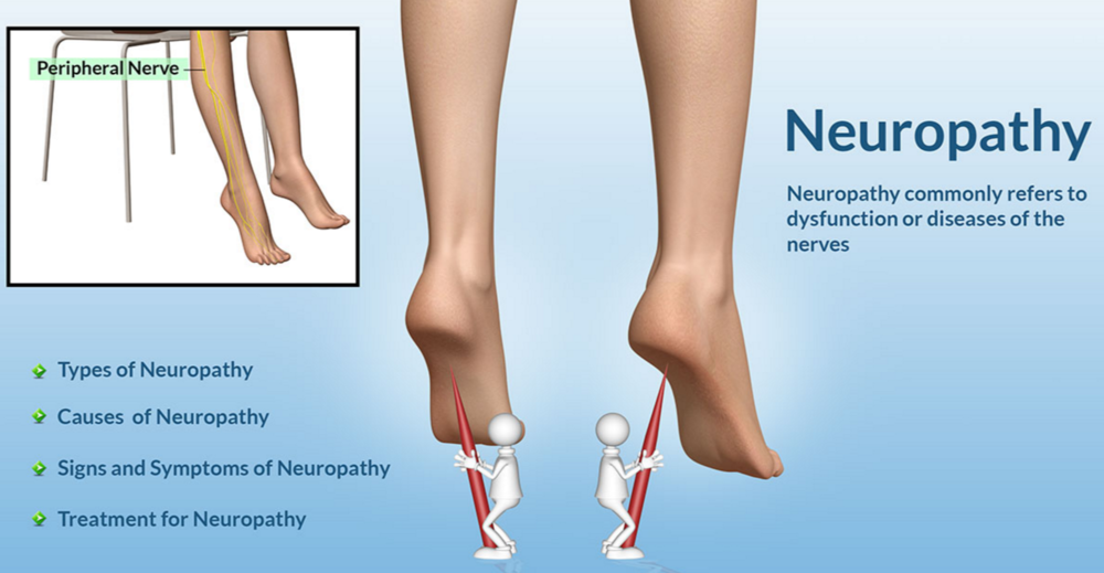 Neuropathy