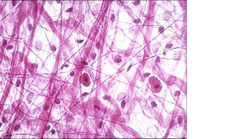 Café y Biología: Lección 29 Tejidos del cuerpo humano. Tejido conjuntivo
