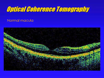 OCT Spectrometer: Know About The OCT Spectrometer