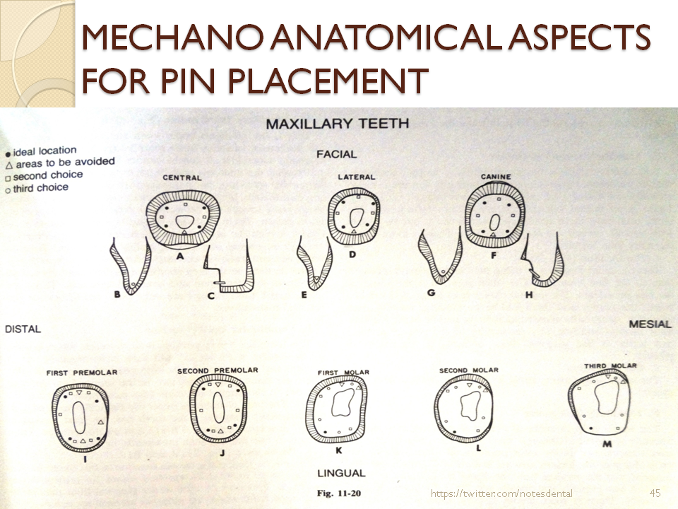 Dental Notes: Pin Retained Restorations NOTES