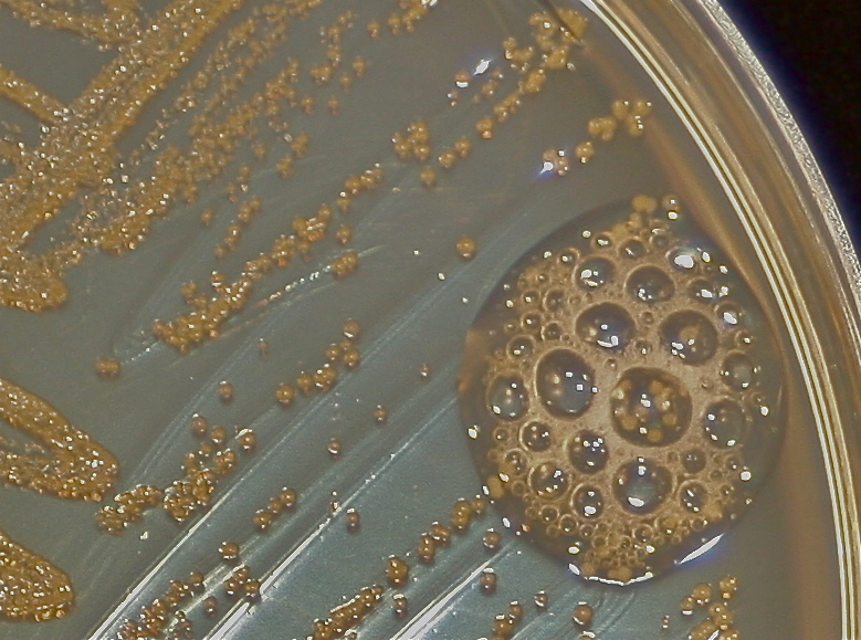 Staphylococcus Aureus Catalase Test