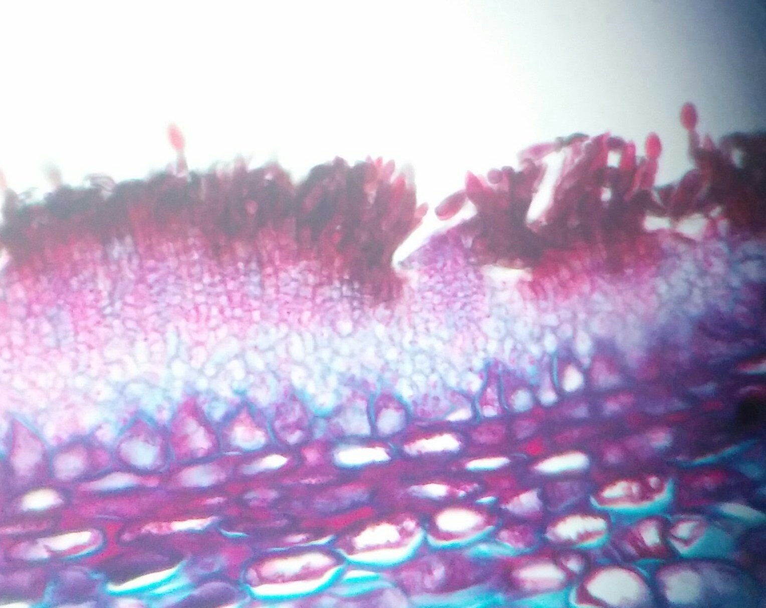 Fungal Plant Pathology: October 2015